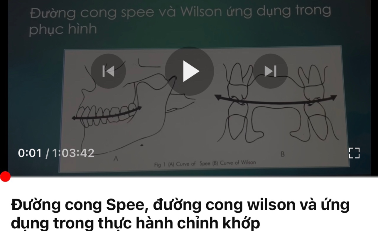 Bài 5:Hiểu biết về đường cong Spee và Wilson và ứng dụng trong thực hành chỉnh khớp.